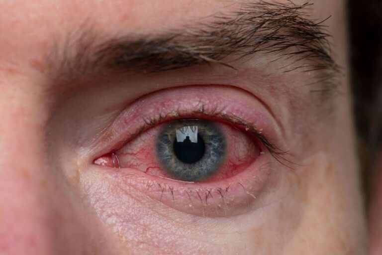Why do my eyes feel gritty and itchy? | Ocutears