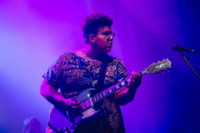 10 celebrities with eye conditions | Ocuwellness